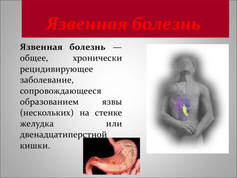 Почему Бывает Отрыжка: Причины, Лечение + 10 Способов Избежать